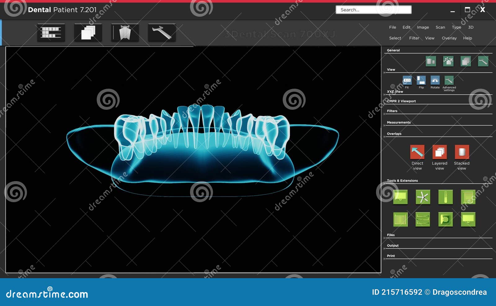 Interface of Software App User Interface with Dental Xray Scan , Stock ...