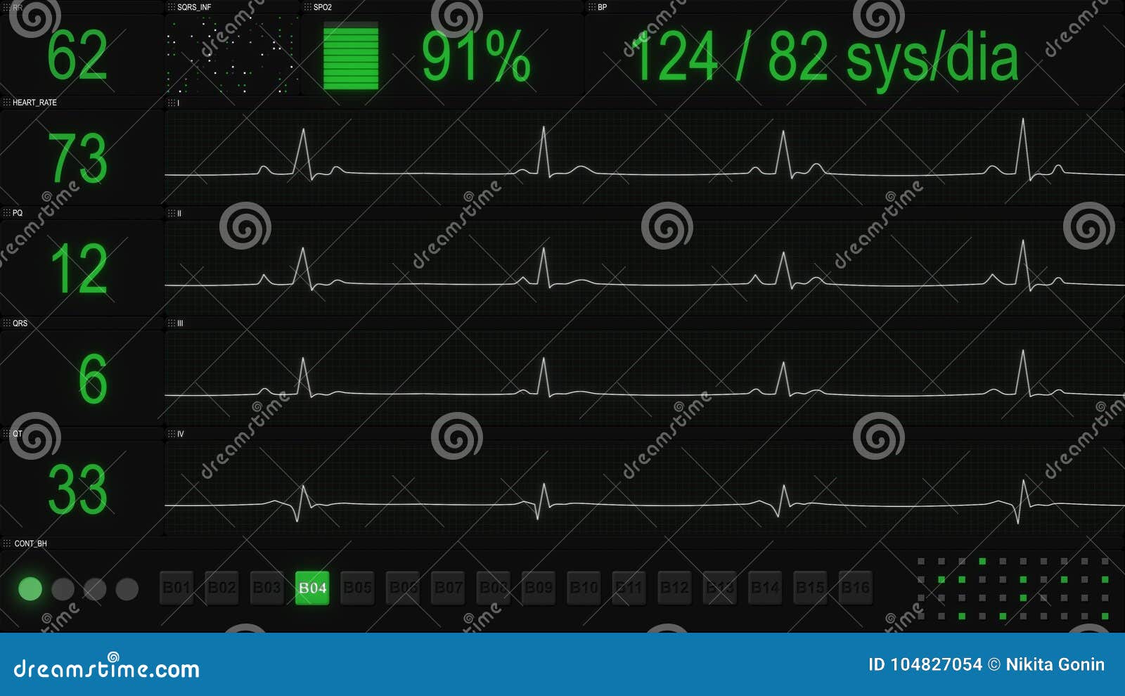 Interfaz De Usuario Del Software De La Prueba De ECG Stock de ...