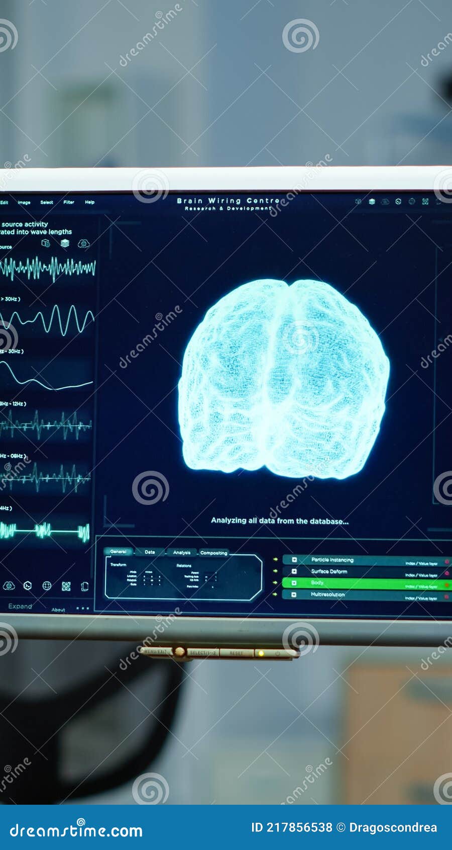 Interior of Empty Science Laboratory for Neurological Treatment Stock ...