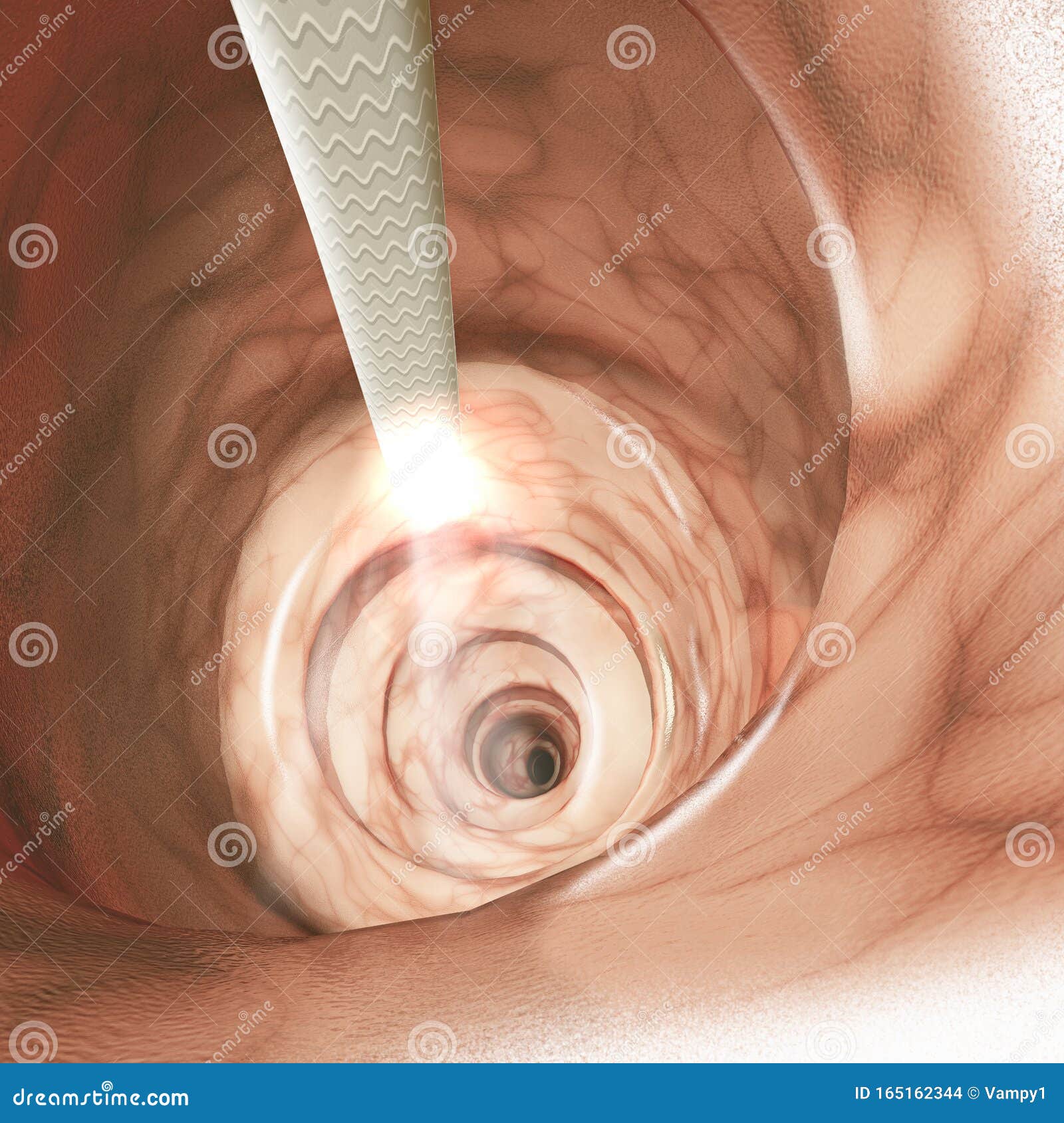 Colonoscopy Examination Colon Digestive System Royalty-Free Stock Image ... Colonoscopy Examination Colon Digestive System Royalty-Free Stock Image ...