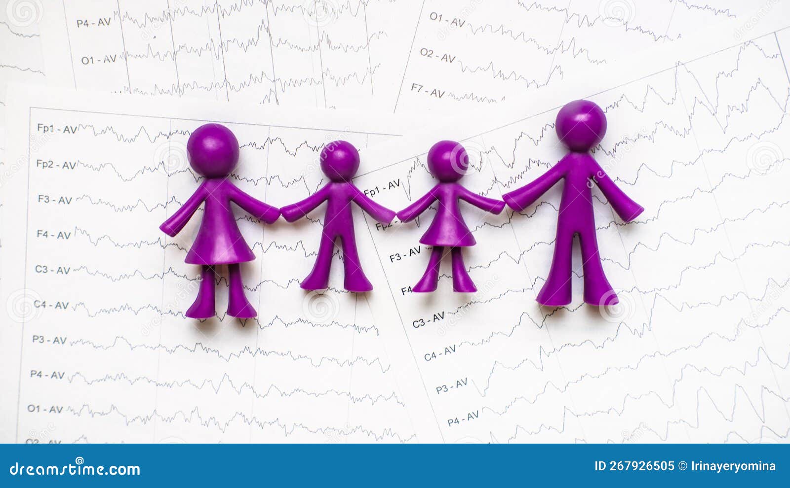 Brain Wave On Electroencephalogram, EEG Chart, EEG Of Children`s Brain ... Brain Wave On Electroencephalogram, EEG Chart, EEG Of Children`s Brain ...