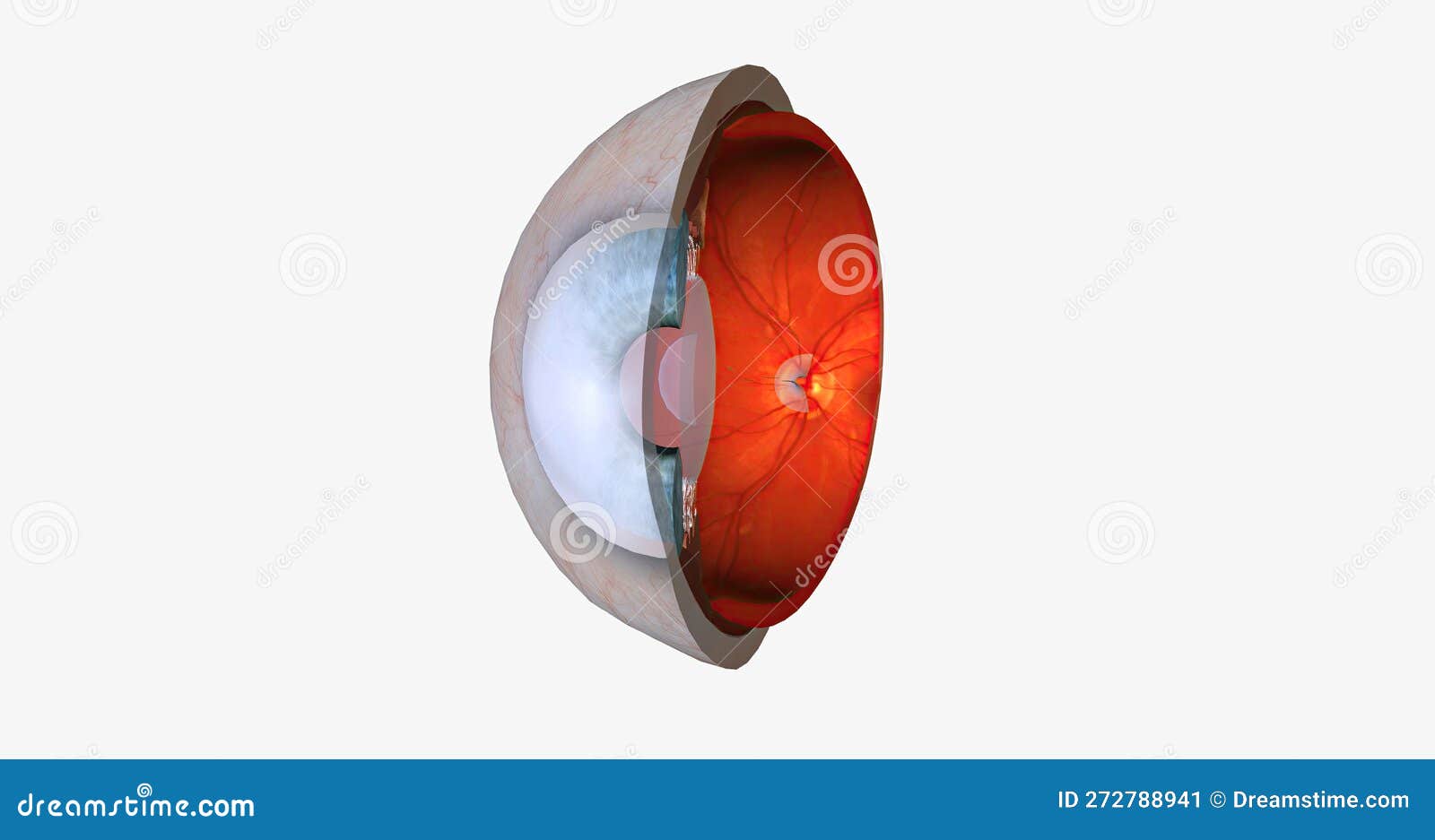 Interstitial Keratitis is Inflammation of the Tissue of the Cornea, the ...