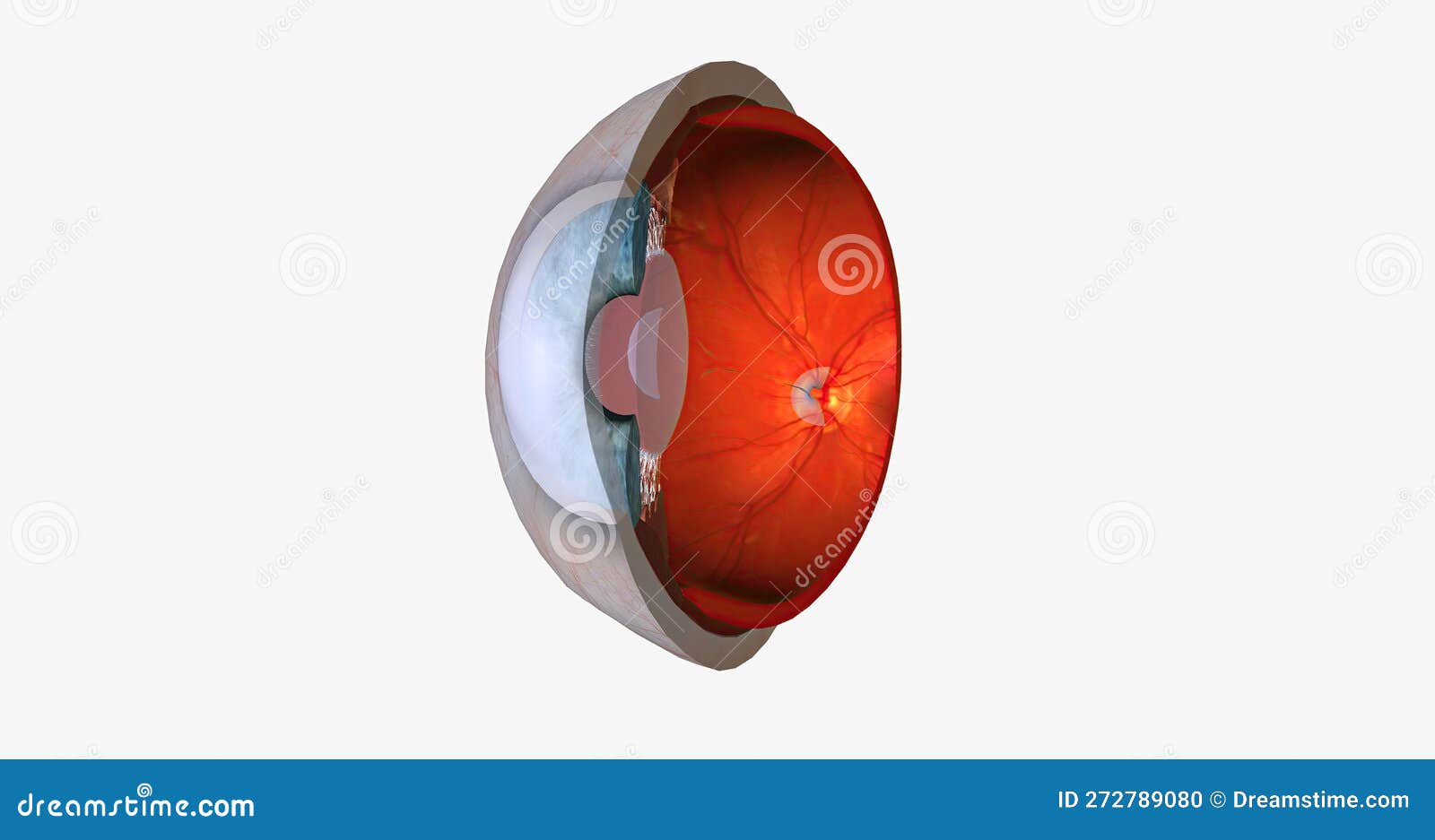 Interstitial Keratitis is Inflammation of the Tissue of the Cornea, the ...