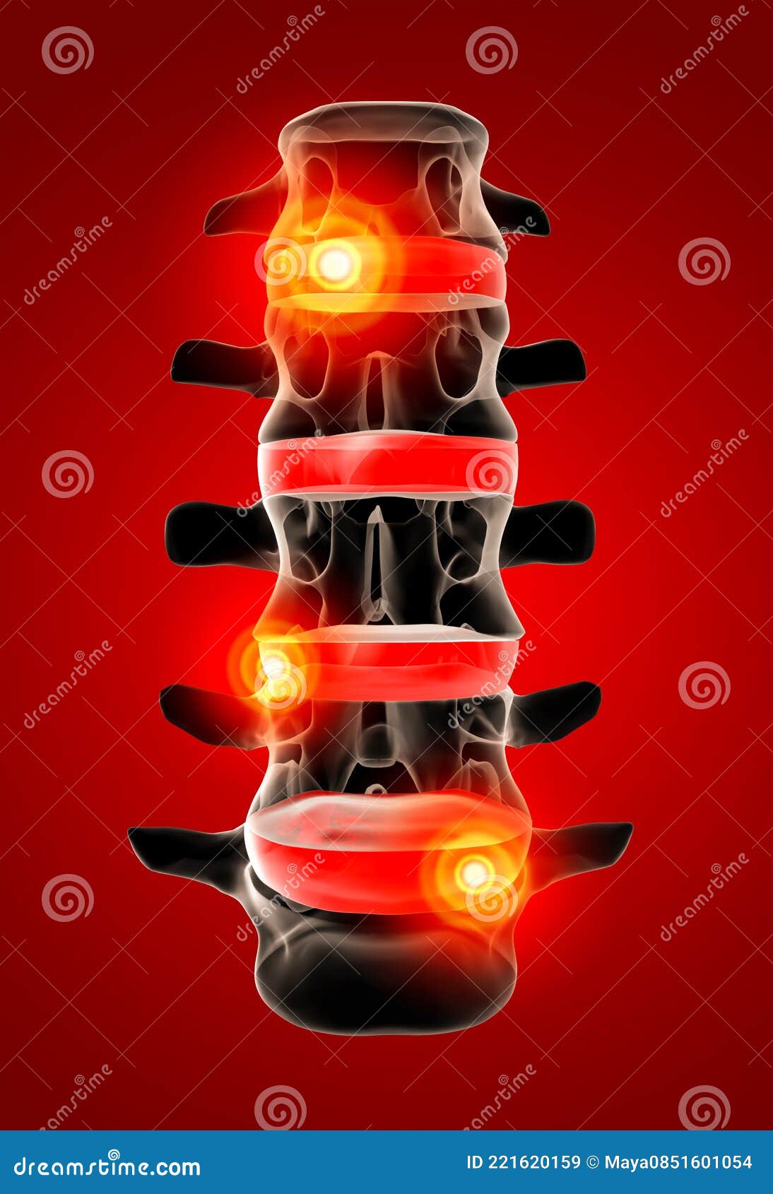 3D Rendering Illustration Of Intervertebral Discs Stock Image ...