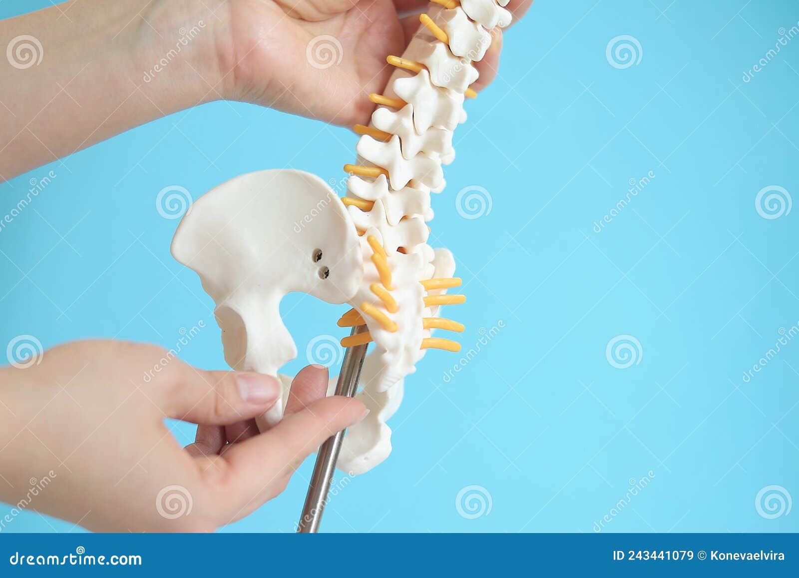 Intervertebral Hernia of the Cervical Spine, Rupture of the Fibrous ...