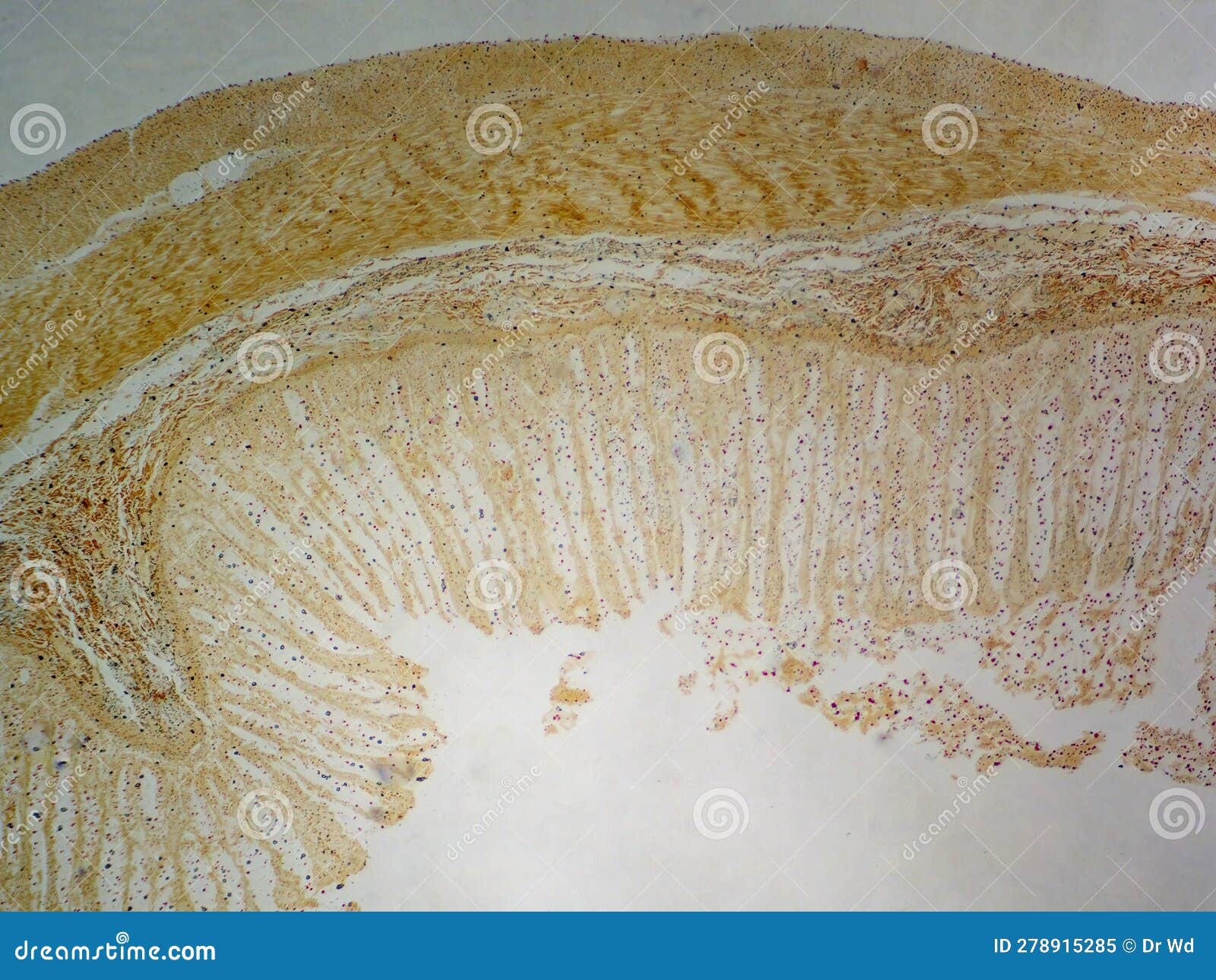 Intestinal Depth: Small Intestine Layers Uncovered at 40x Stock Image ...