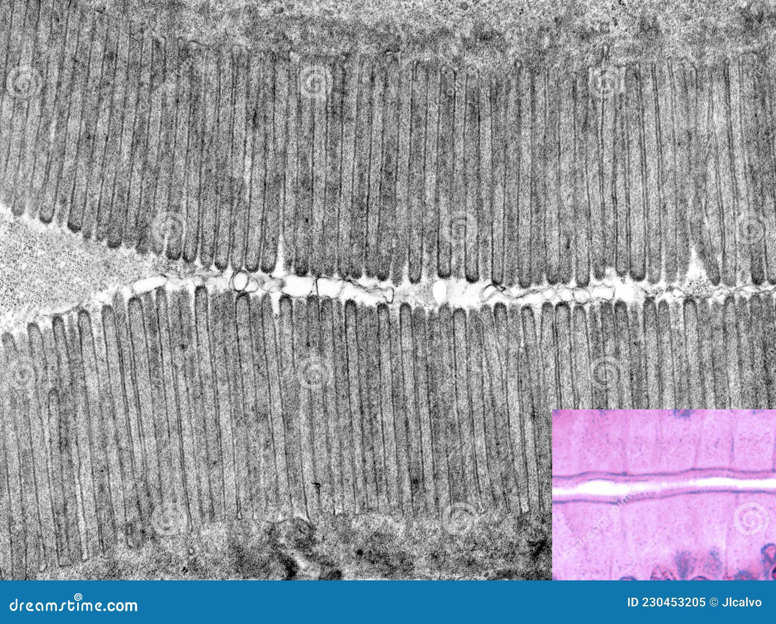 Intestinal Epithelium. Brush Border Royalty-Free Stock Photo ...