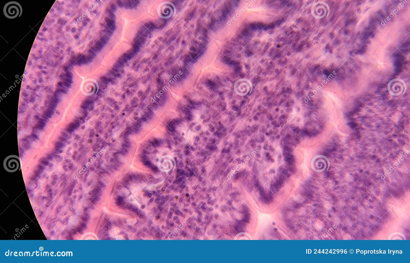 Intestinal Villi Under a Microscope Stock Photo - Image of anatomy ...
