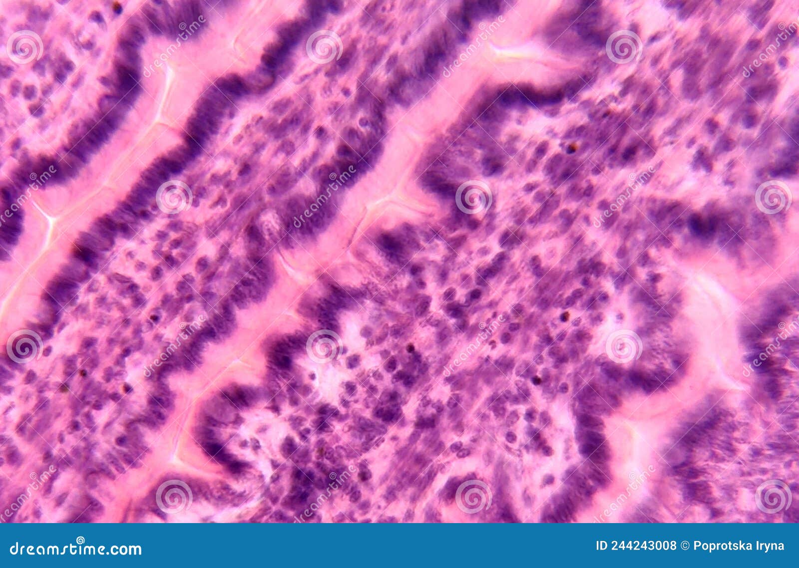 Intestinal Villi Under a Microscope Stock Photo - Image of ciliated ...