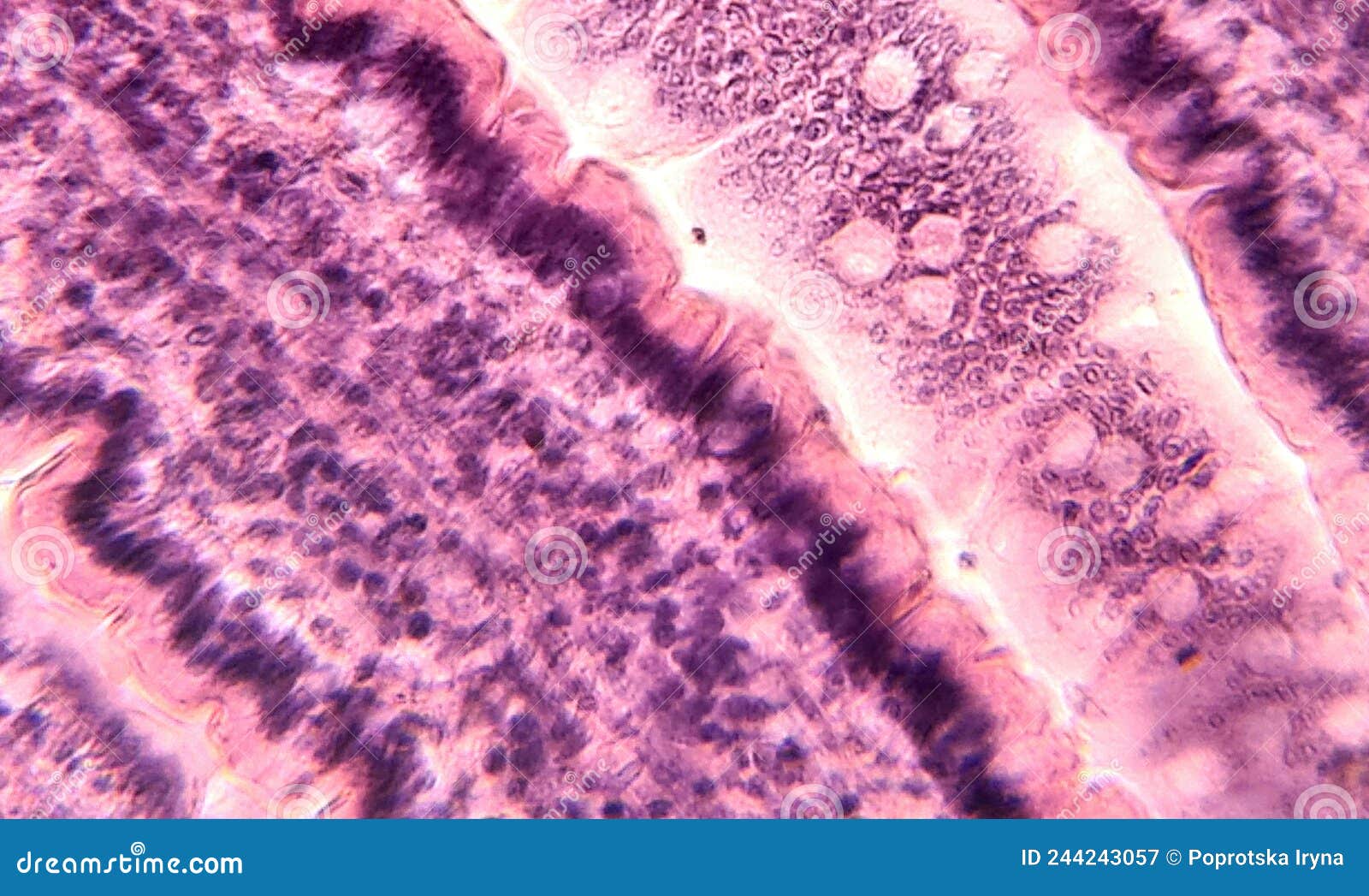 Intestinal Villi Under a Microscope Stock Image - Image of epithelial ...