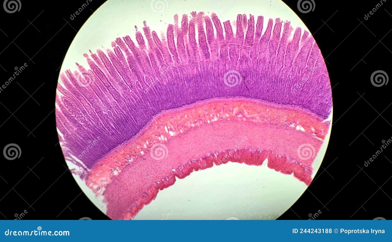 Intestinal Villi Under a Microscope Stock Photo - Image of anatomy ...