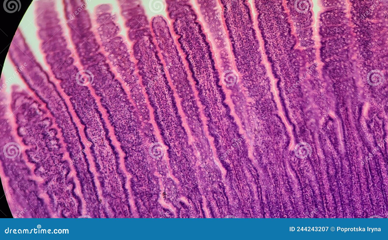 Permanent Preparation of Intestinal Villi Under a Microscope Stock ...