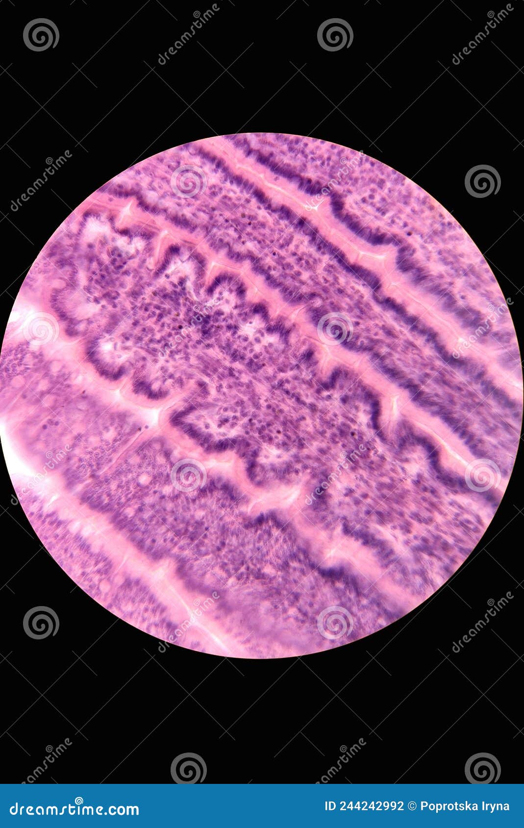 Intestinal Villi Under a Microscope Stock Photo - Image of anatomy ...
