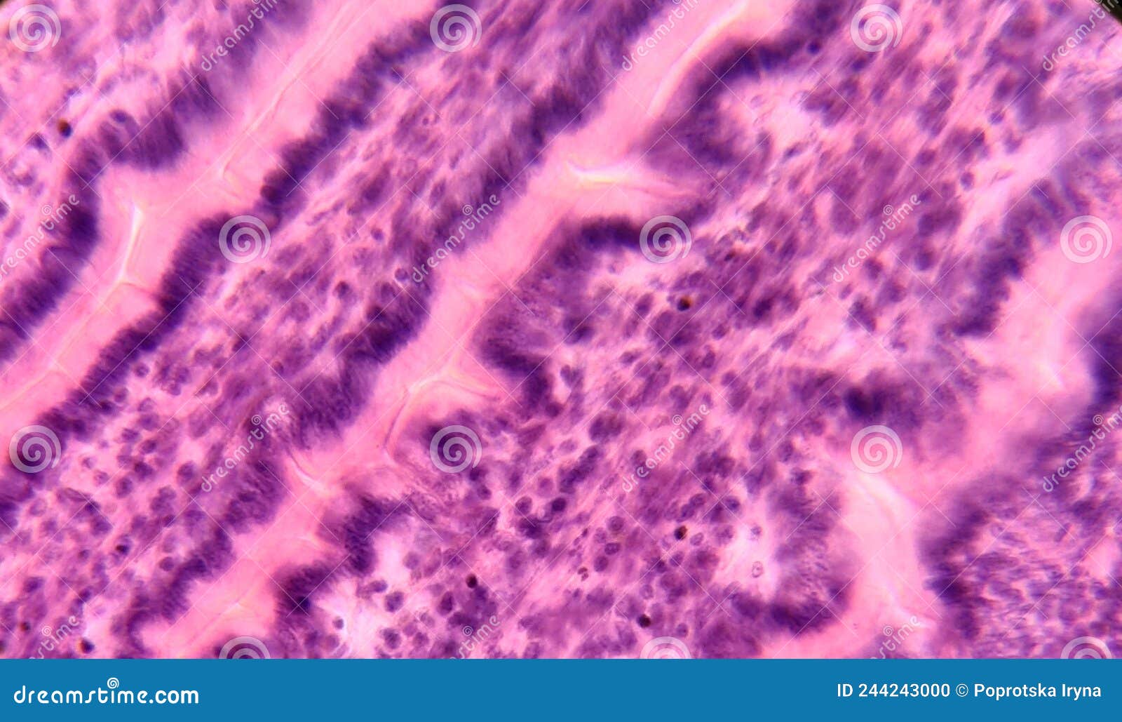 Intestinal Villi Under a Microscope Stock Photo - Image of body ...