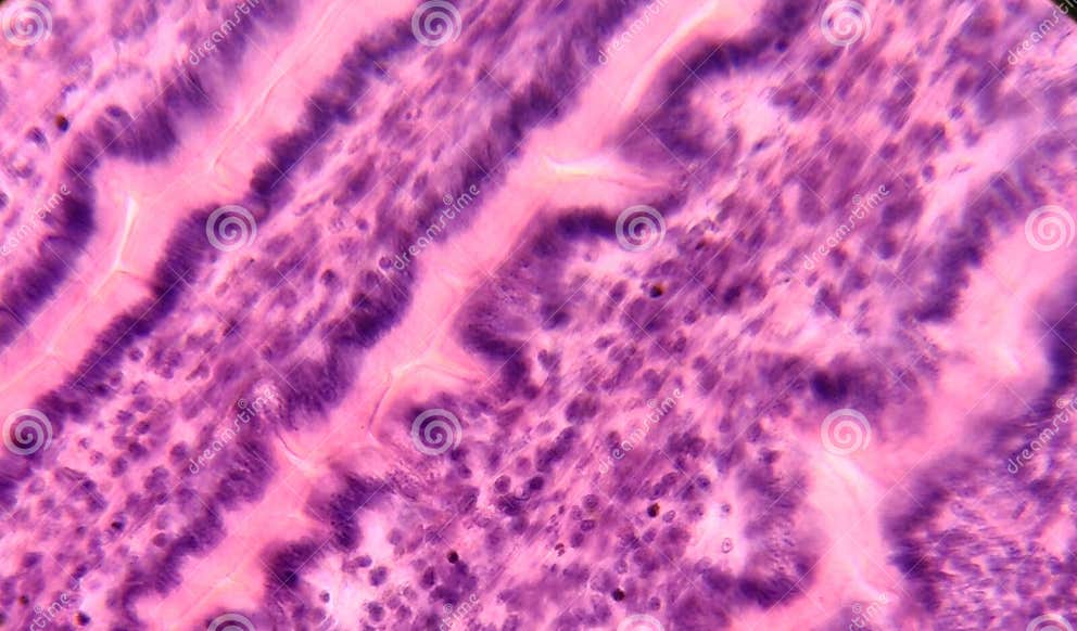 Intestinal Villi Under a Microscope Stock Photo - Image of body ...