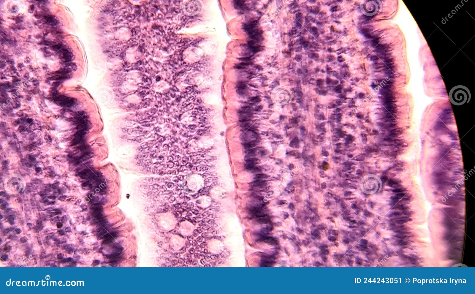 Intestinal Villi Under a Microscope Stock Image - Image of prismatic ...
