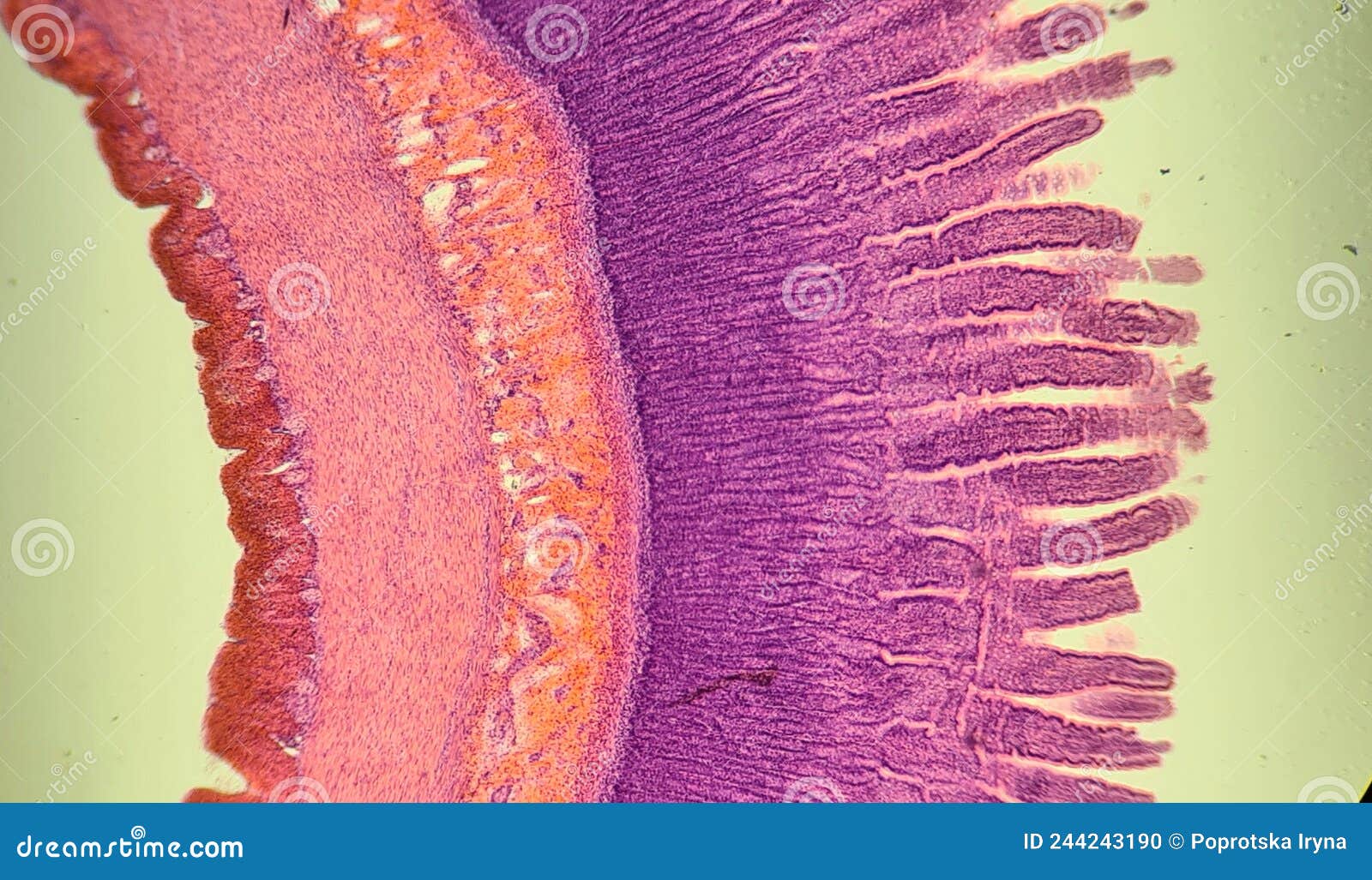 Intestinal Villi Under a Microscope Stock Photo - Image of microscope ...