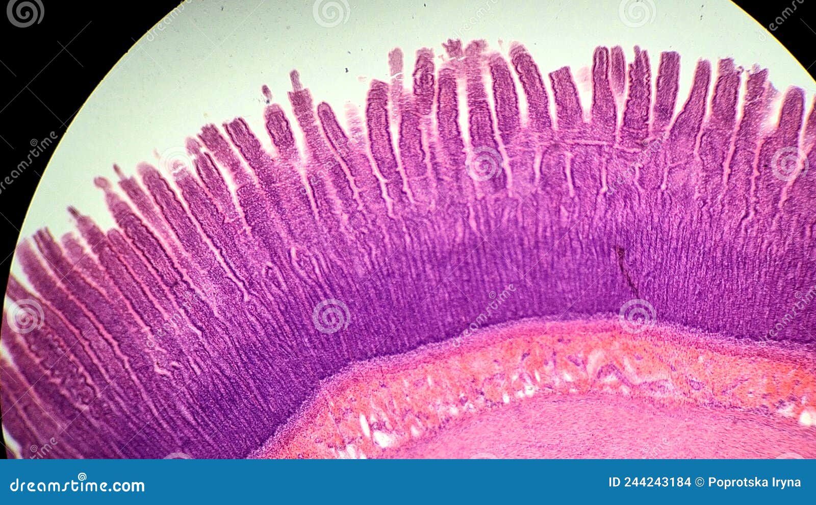 Intestinal Wall Under a Microscope, Permanent Preparation Stock Photo ...