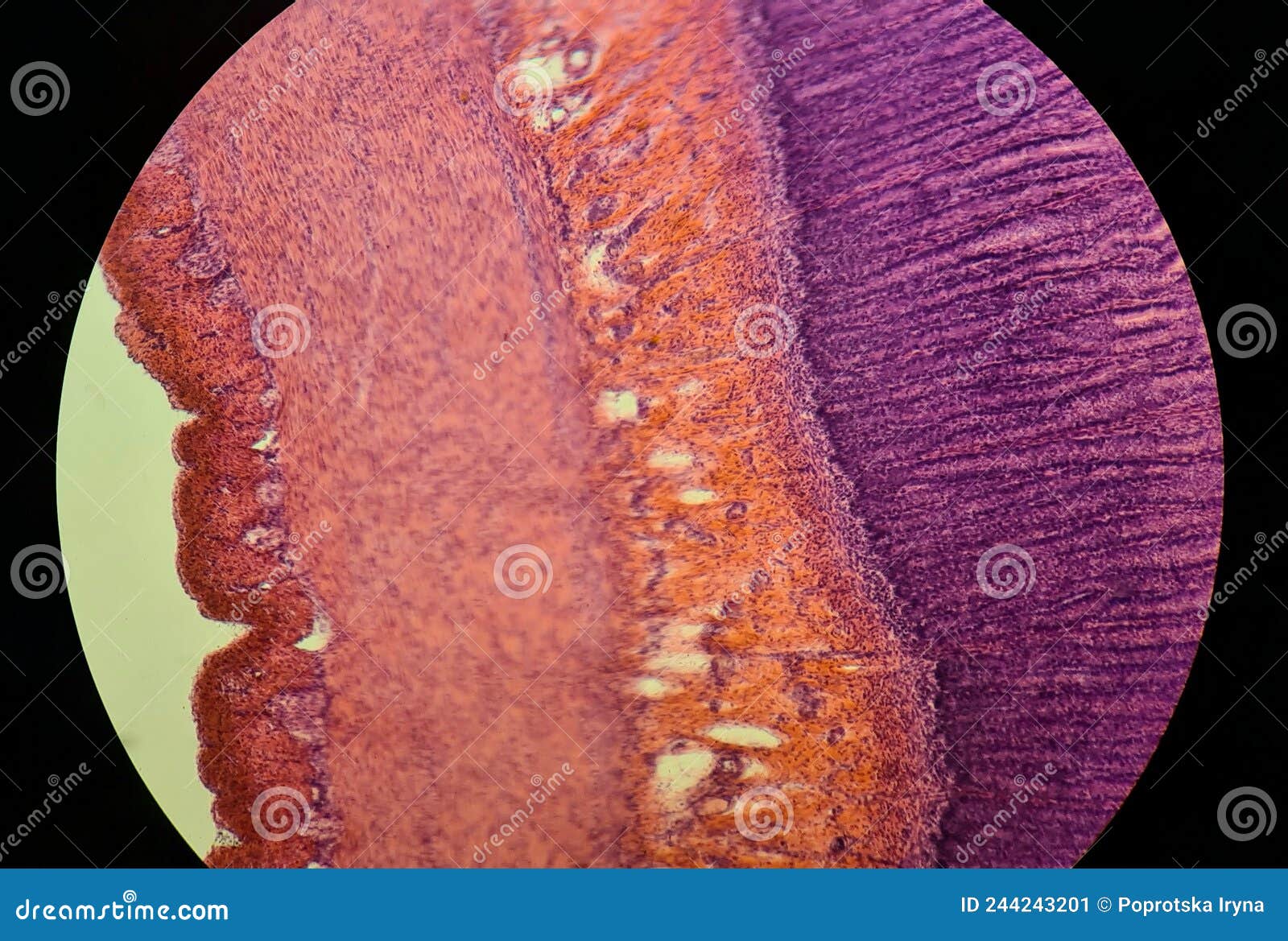Intestinal Wall Under a Microscope, Permanent Preparation Stock Image ...