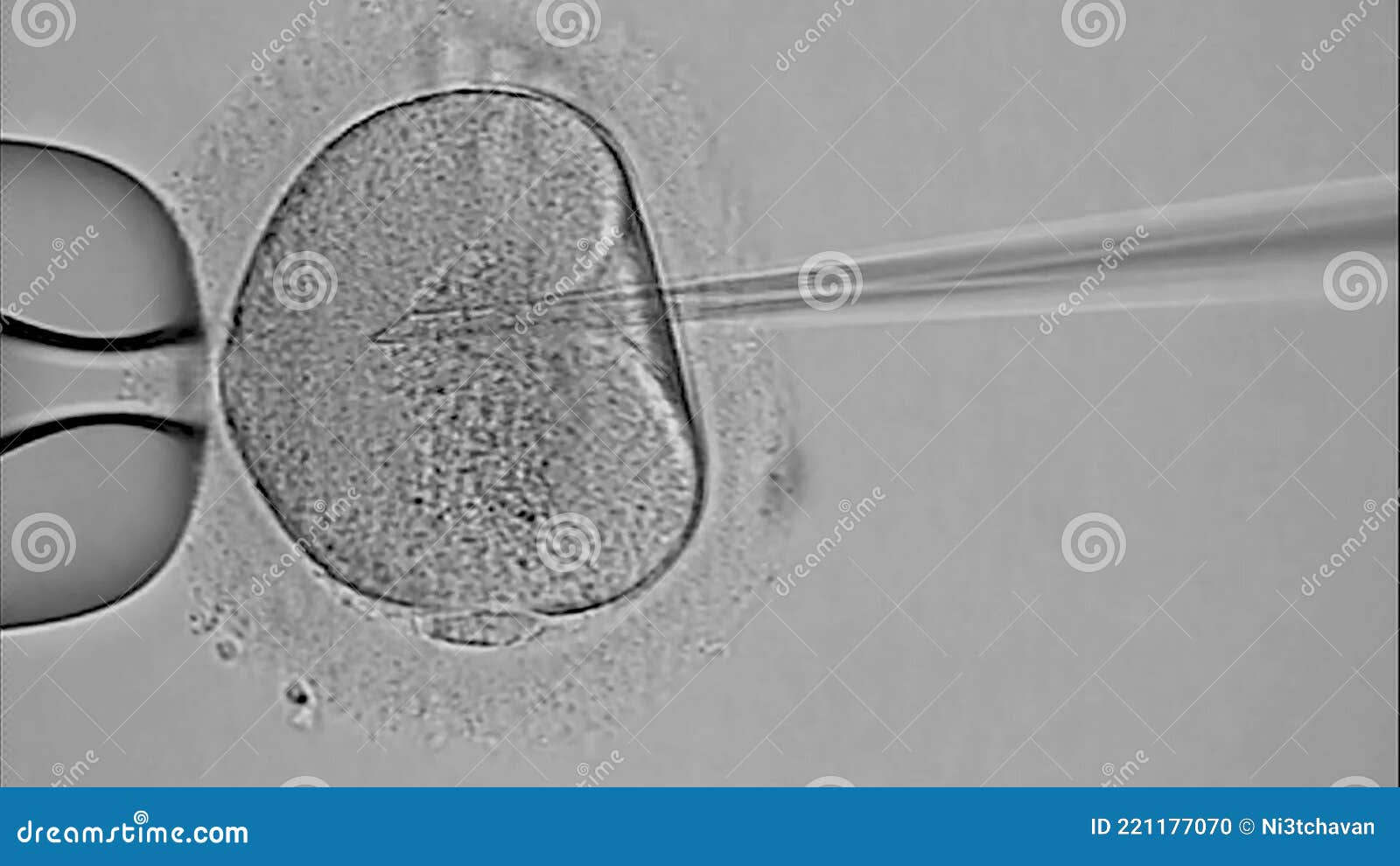 Intracytoplasmic Sperm Injection. Vitro Fertilisation Process. Stock ...