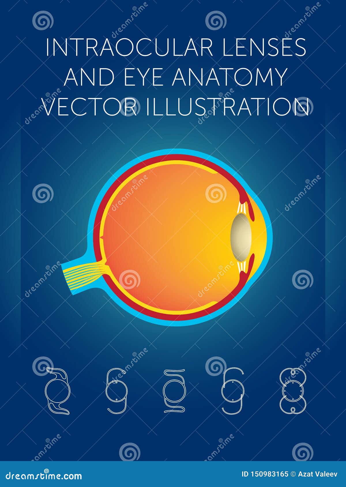 Types Of Intraocular Lenses Stock Photography | CartoonDealer.com ...