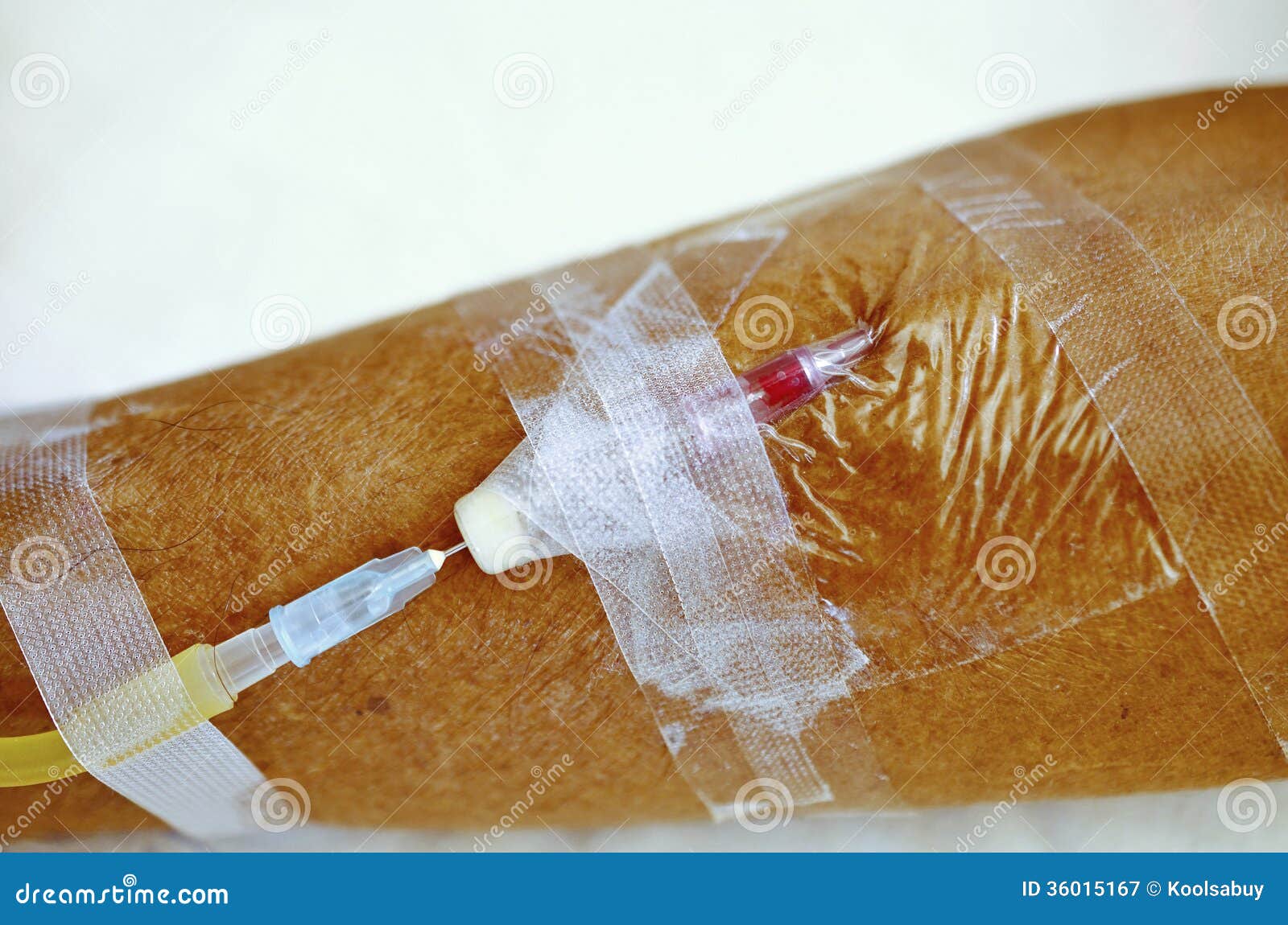 Intravenous injection stock image. Image of sick, medicine - 36015167