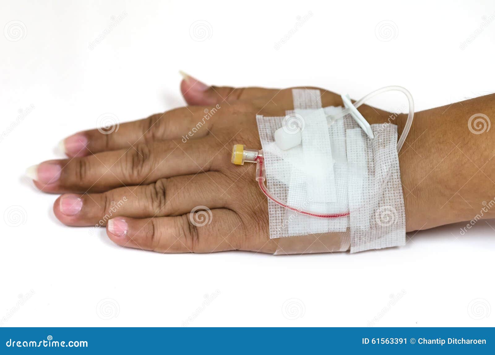 An Intravenous Saline Solution at Hand Stock Image - Image of help ... An Intravenous Saline Solution at Hand Stock Image - Image of help ...