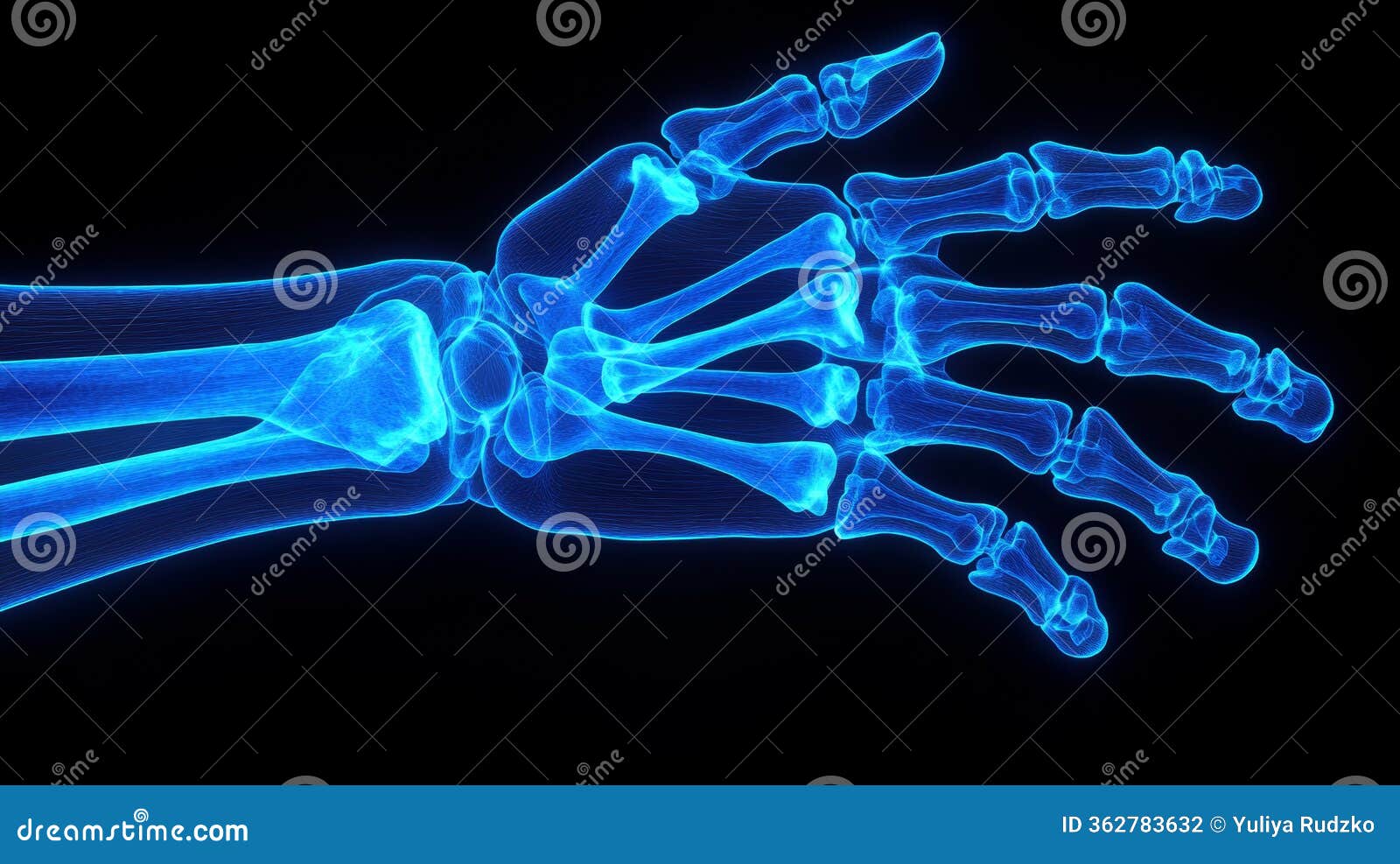 An Intricate Digital X-ray Image of a Human Hand S Skeletal Structure ...
