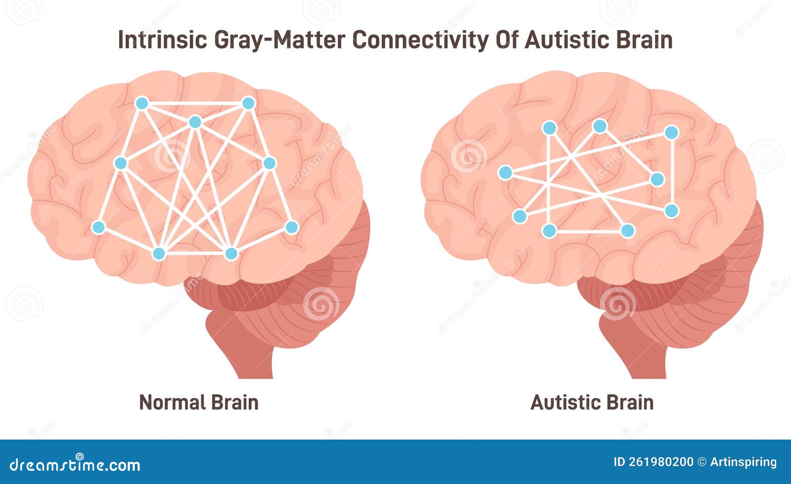 Intrinsic Gray Matter Connectivity Of Autistic Brain