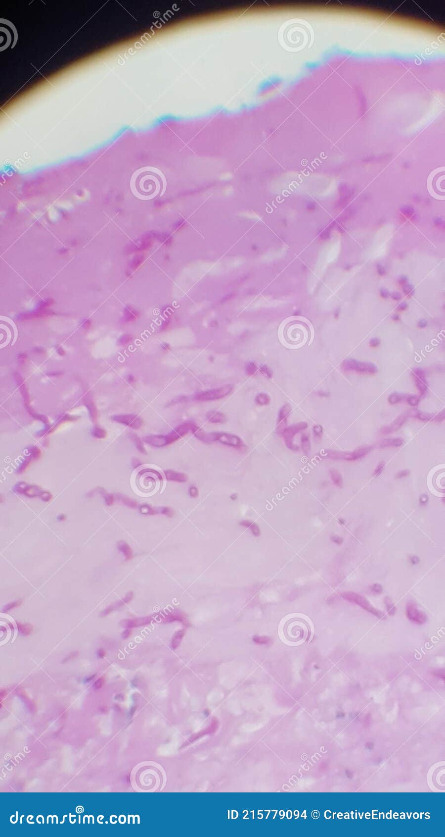 Invasive Fungal Hyphae On H And E Tissue Stain Royalty-Free Stock Photo ...