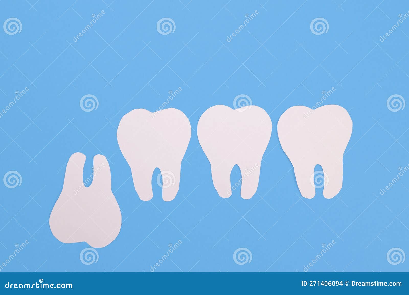 Inverted Problematic Wisdom Tooth Made of Paper on a Blue Background ...