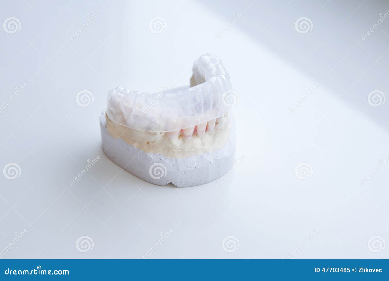 Invisalign, Invisible Plastic Teeth Aligner Stock Image - Image of ...