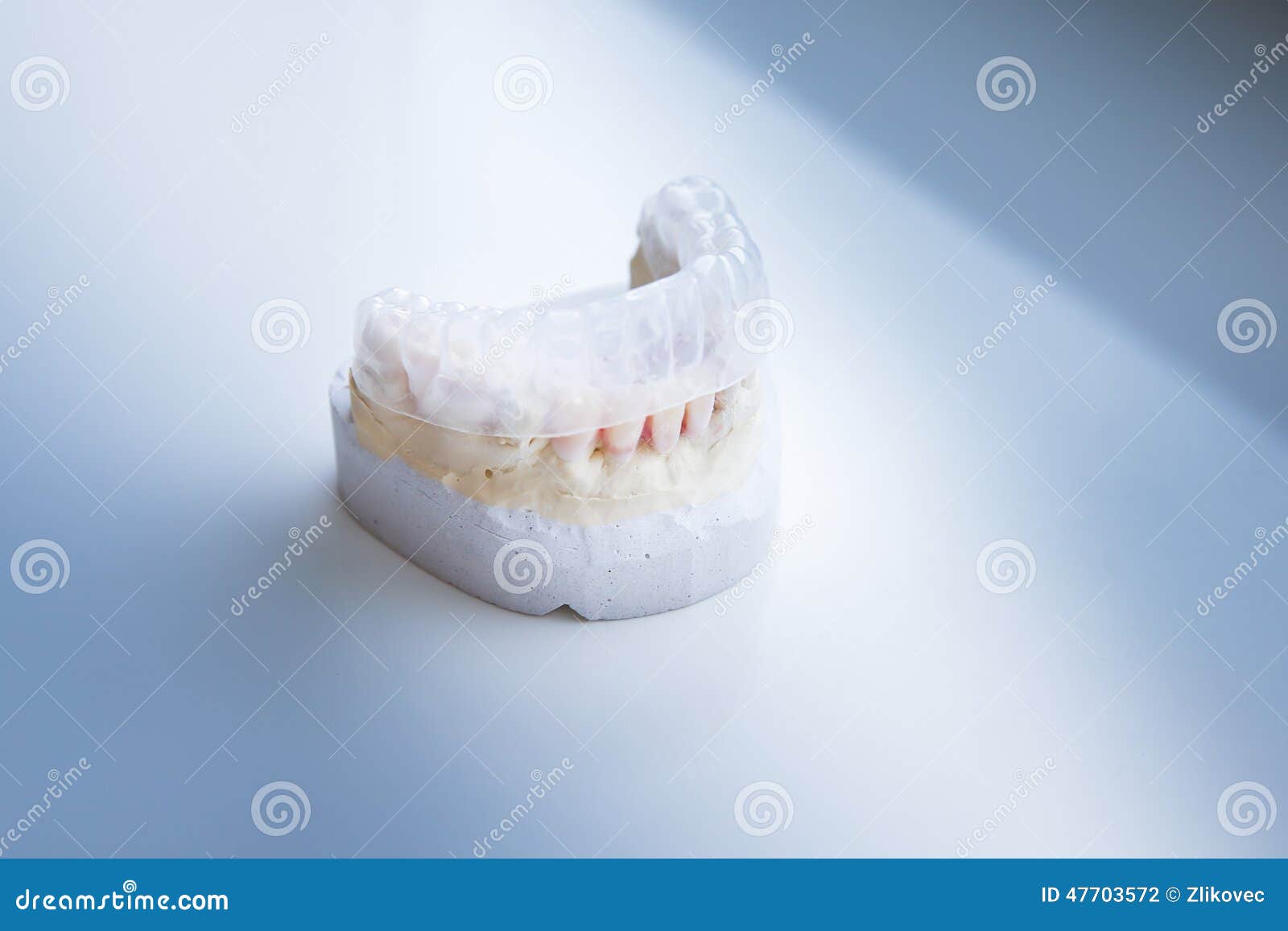 Invisalign, Invisible Plastic Teeth Aligner Stock Photo - Image of ...