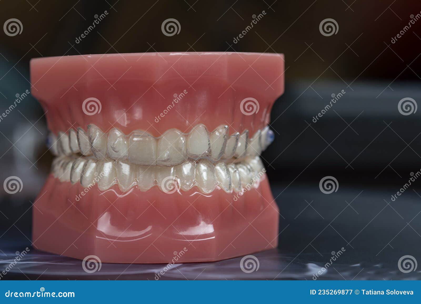 Invisible Braces Orthodontic Removable Aligners for Teeth Treatment ...