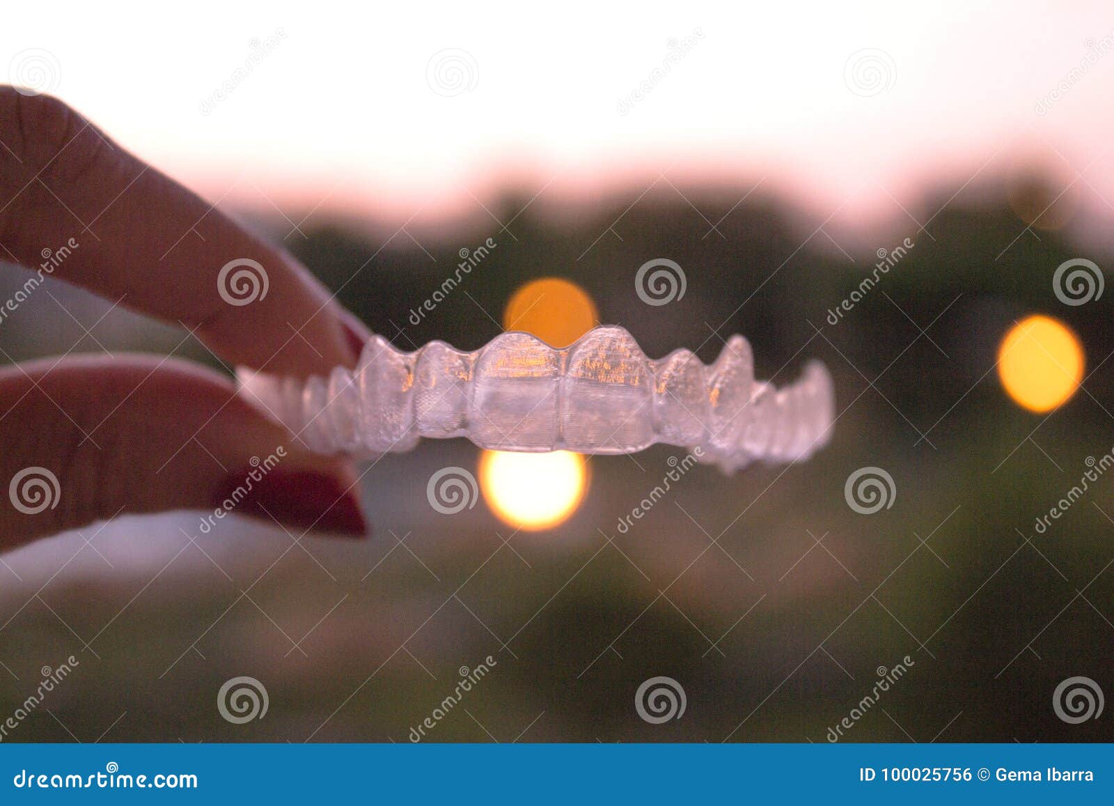 Orthodontics To Correct Alignment of Teeth Stock Photo - Image of ...