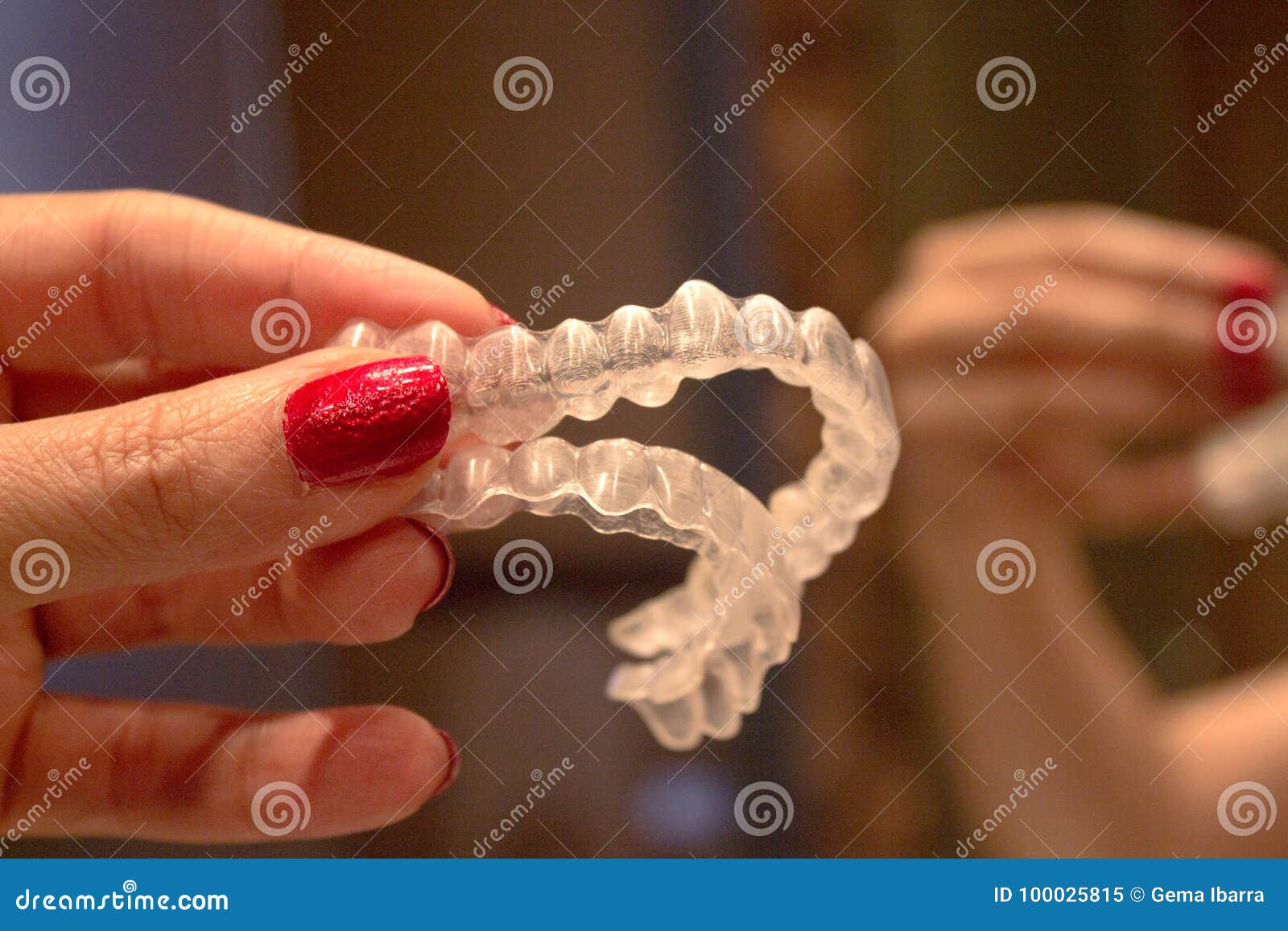 Orthodontics To Correct Alignment of Teeth Stock Image - Image of ...
