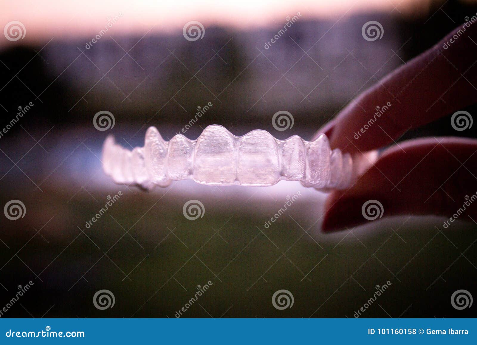 Orthodontics To Correct Alignment of Teeth Stock Photo - Image of teeth ...