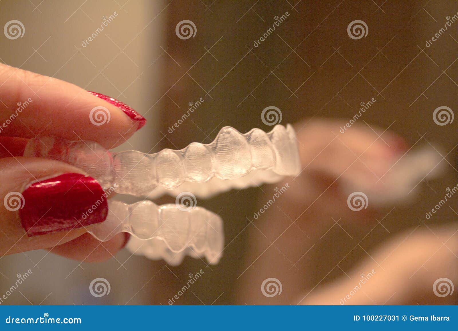 Orthodontics To Correct Alignment of Teeth Stock Image - Image of ...