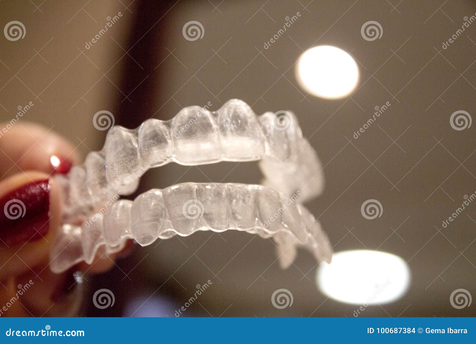 Orthodontics To Correct Alignment of Teeth Stock Photo - Image of ...