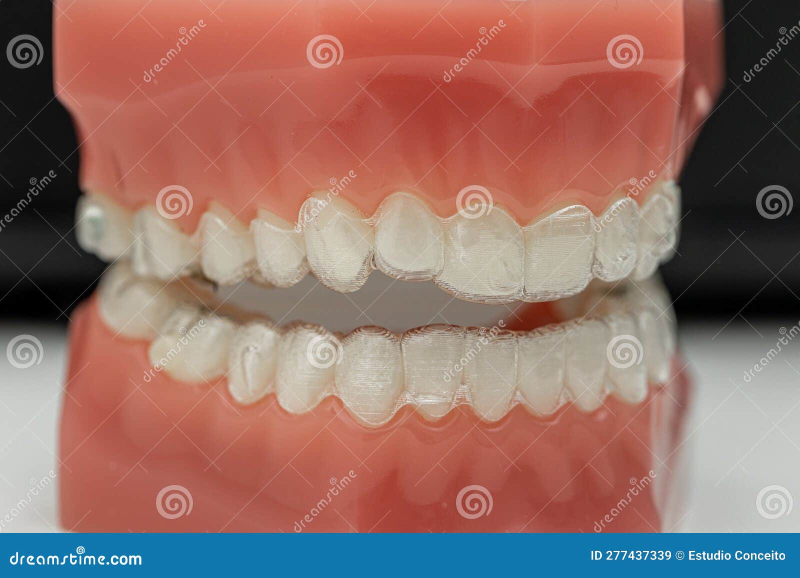 Invisible and Removable Aligners for Teeth Alignment. Stock Image ...