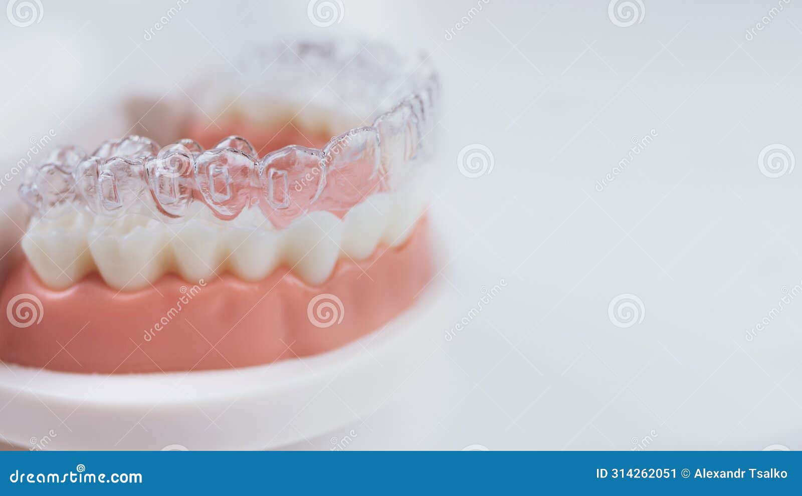 Invisible and Removable Aligners for Teeth Alignment Stock Image ...