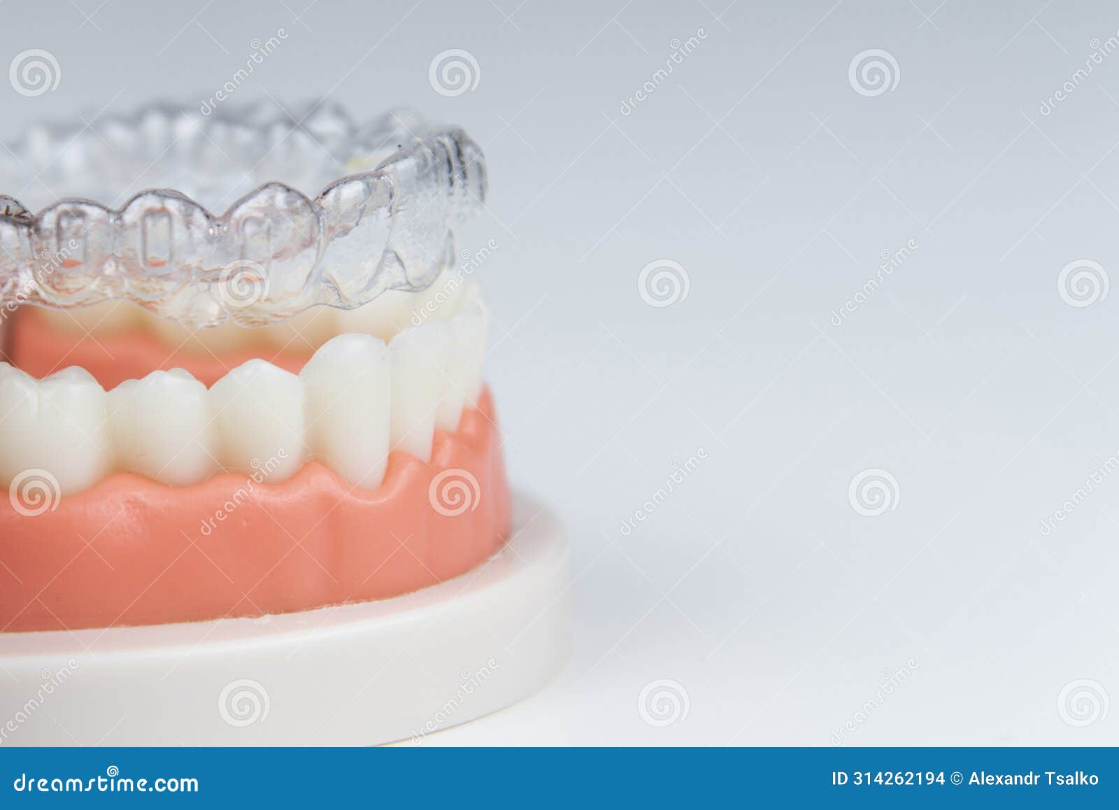 Invisible and Removable Aligners for Teeth Alignment Stock Photo ...