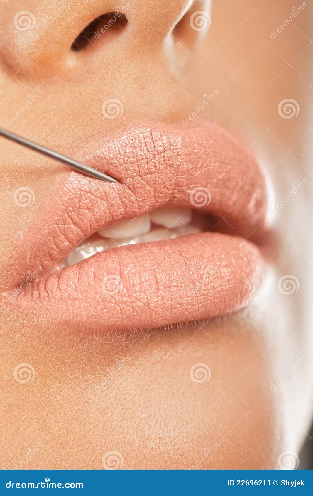 Inyección De Botox En El Labio Imagen de archivo - Imagen de salud ...