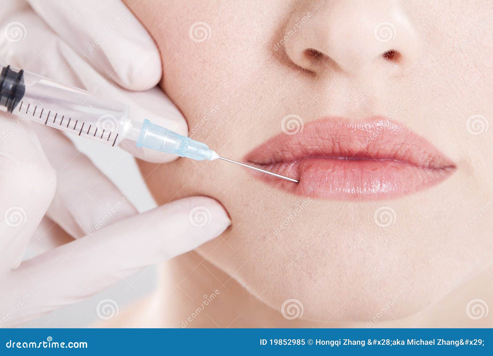Inyección De Botox En Labio Imagen de archivo - Imagen de moderno ...