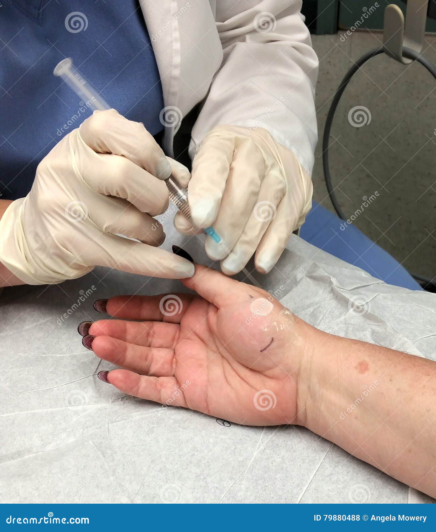 Inyección de la mano foto de archivo. Imagen de aguja - 79880488