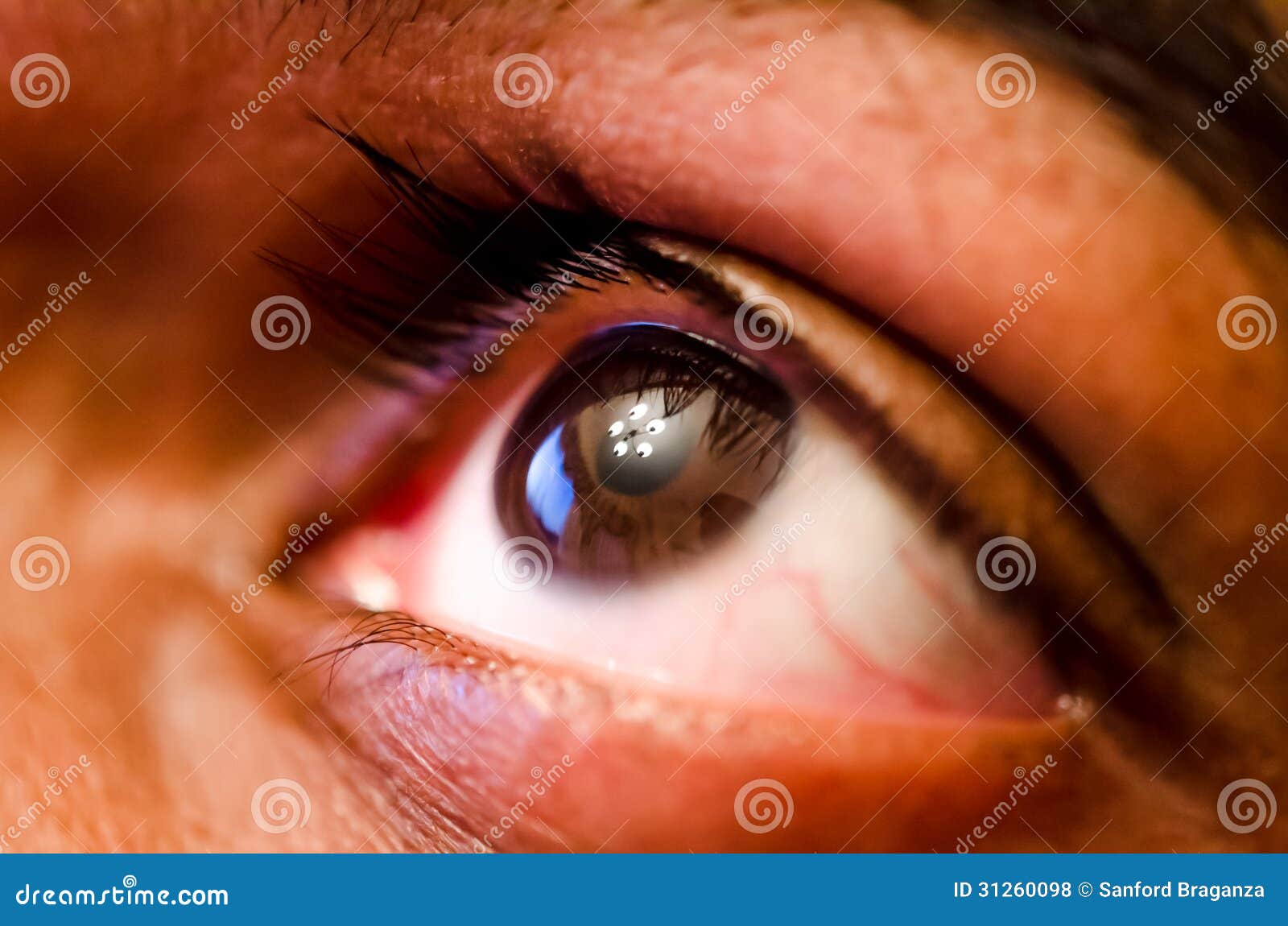 Iris Reflection stock photo. Image of light, catch, iris - 31260098