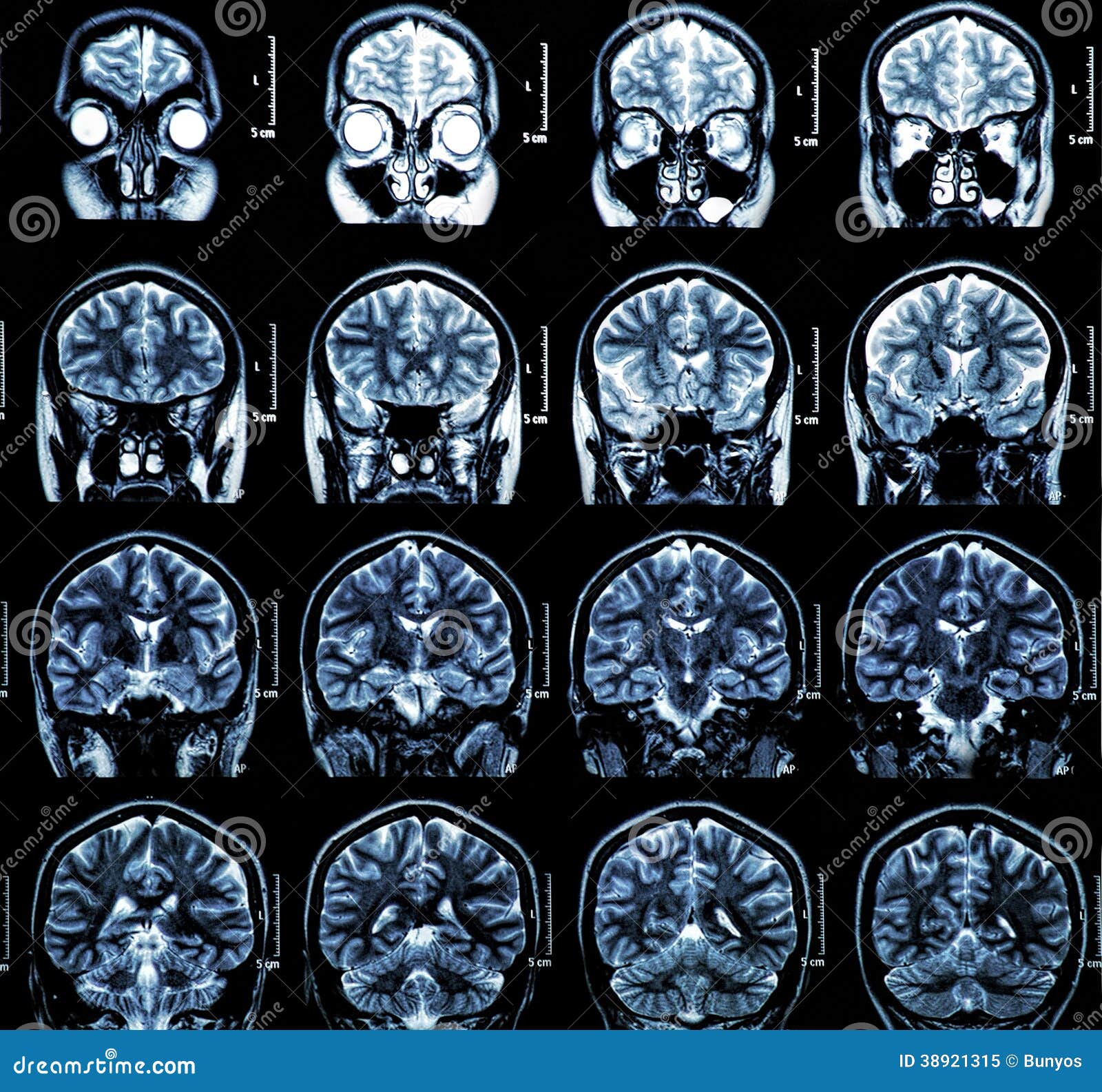 IRM Brain Scan image stock. Image du chat, machine, cavité - 38921315