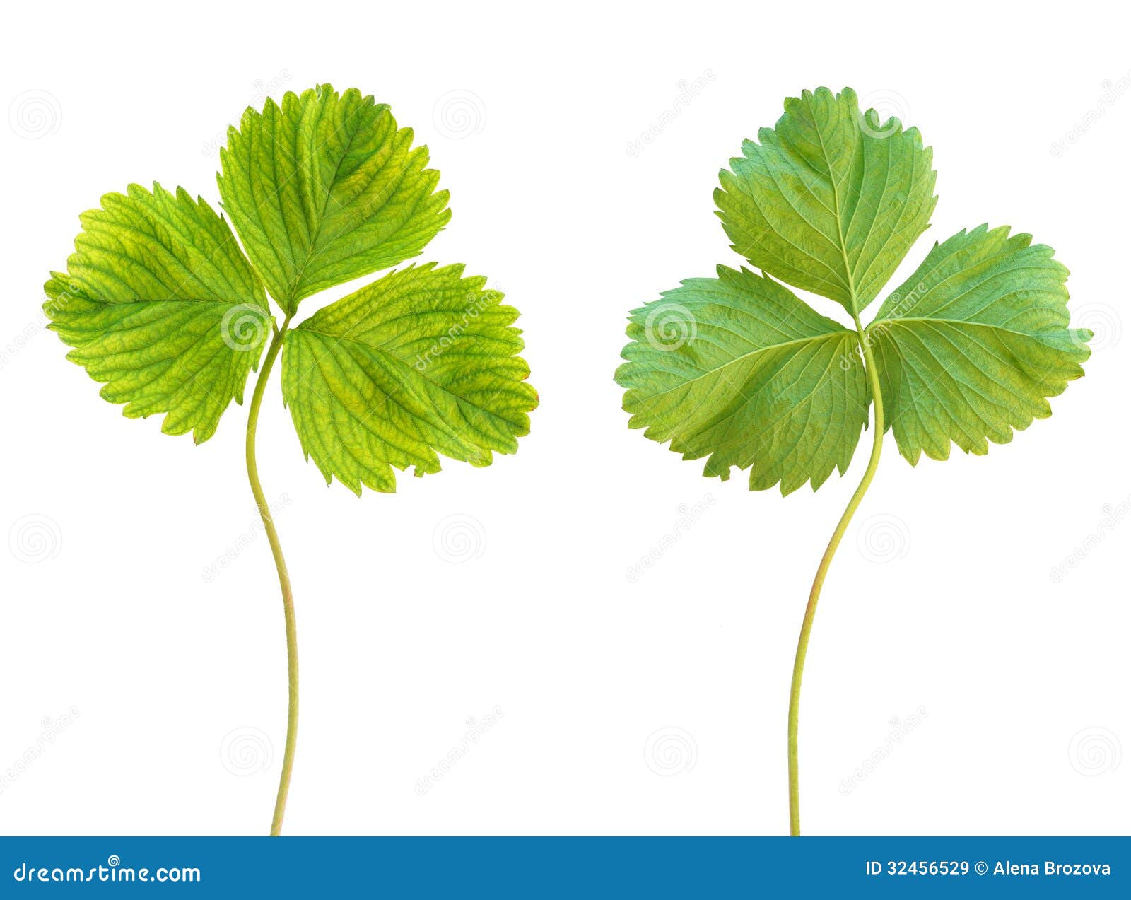 Iron Deficiency Hypochromic Microcytic Anemia, Red Blood Cells Stock ...