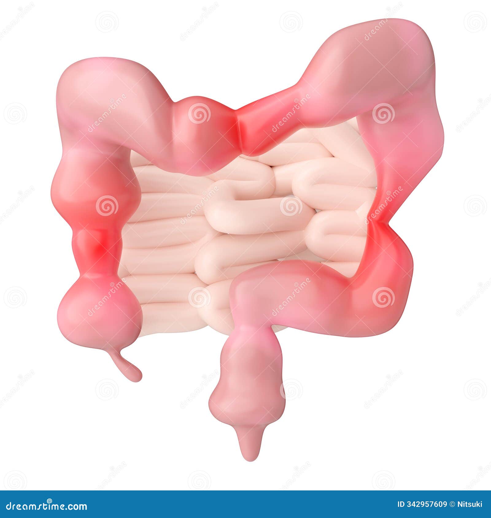 Ibs Symptoms. Irritable Bowel Syndrome Infographic, Stomach Digestive ...