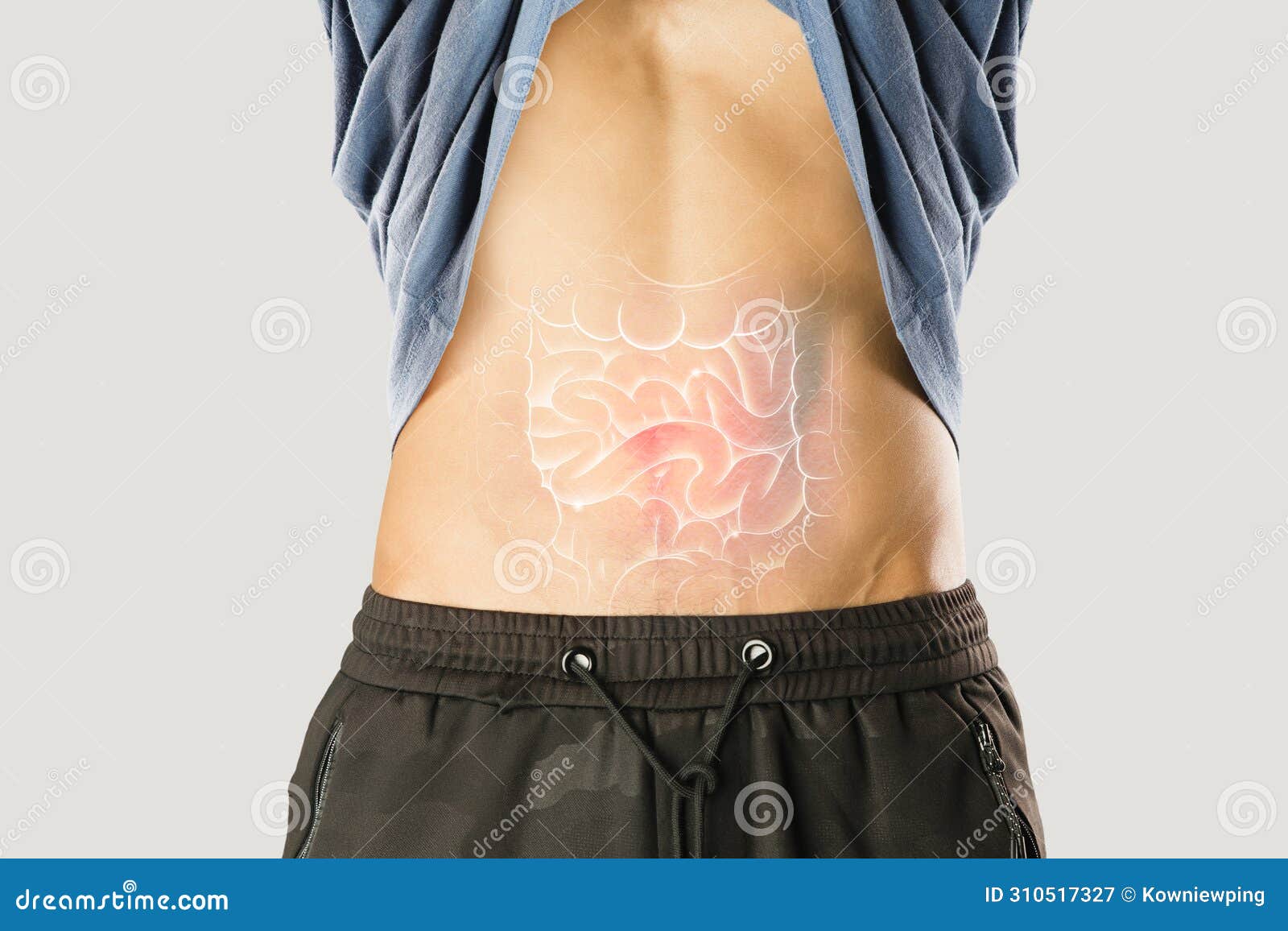 Irritable bowel syndrome stock image. Image of maltase - 310517327